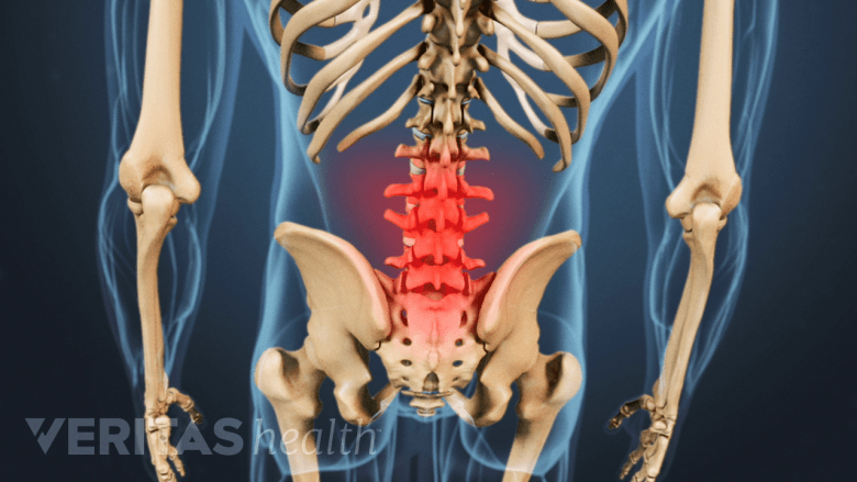 4 Reasons You May Have a Stiff Back | Spine-health