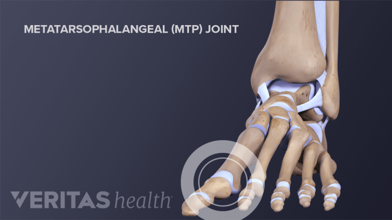 Interphalangeal Joint Toe Toe Joint Deformities