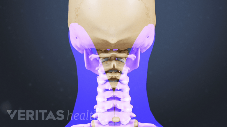 Whiplash Symptoms and Associated Disorders | Spine-health