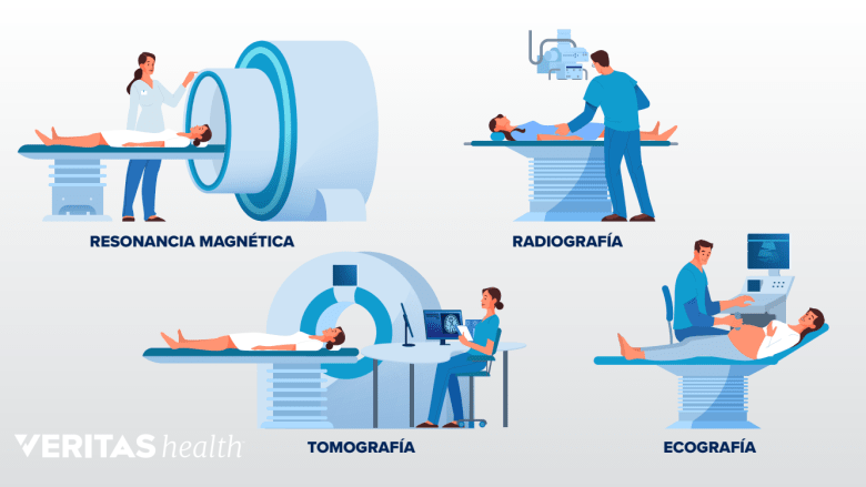 Diagnóstico de la distensión cervical | Spine-health