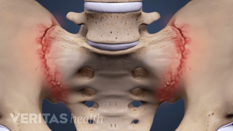 Lower Right Back Pain: Tissues & Spinal Structures | Spine-health