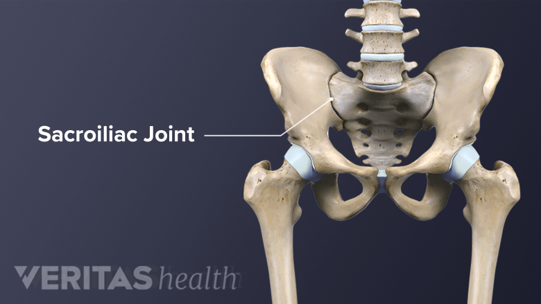 Sacroiliac Fusion Sacroiliac Joint Pain Helena | Spine Deformities