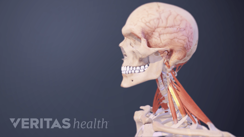 Understanding Neck Spasms | Spine-health