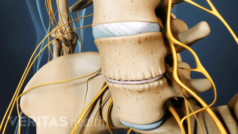 Lumbar Spinal Stenosis | Spine-health