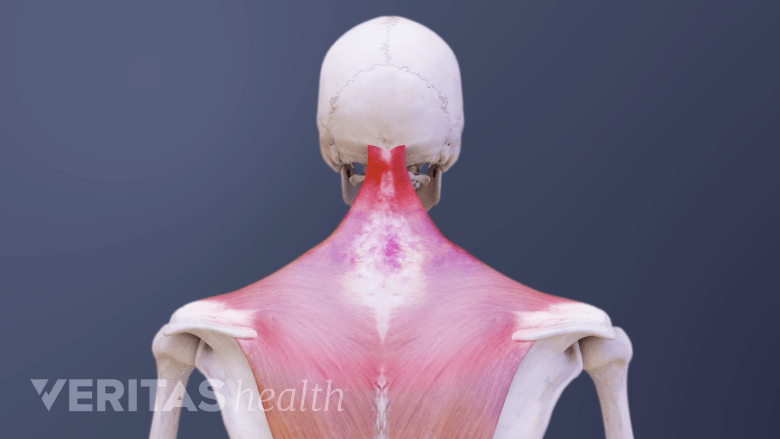 How Does Text Neck Cause Pain? | Spine-health