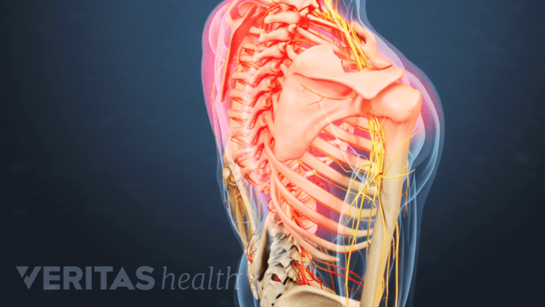 Symptoms of a Spinal Tumor | Spine-health