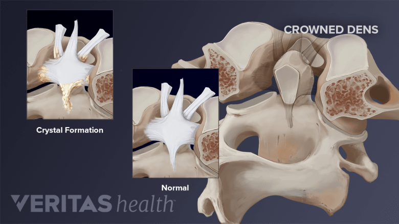 The C1-C2 Vertebrae and Spinal Segment | Spine-health