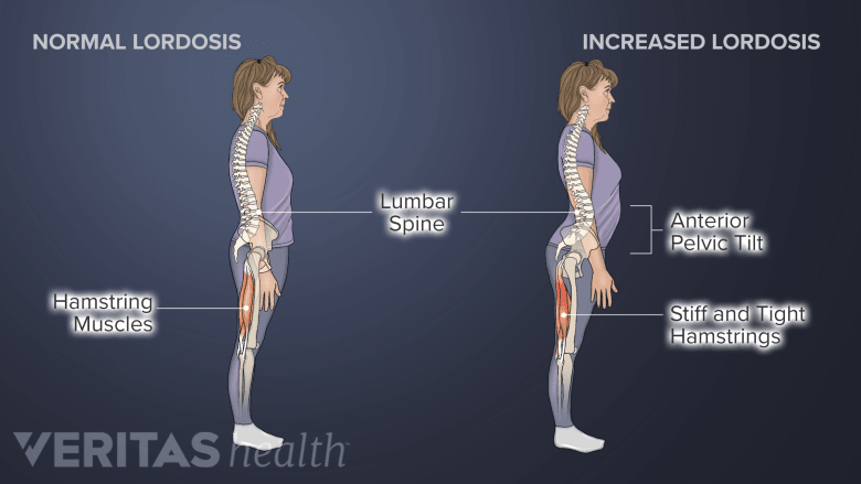 Understanding Lower Back Anatomy | Spine-health