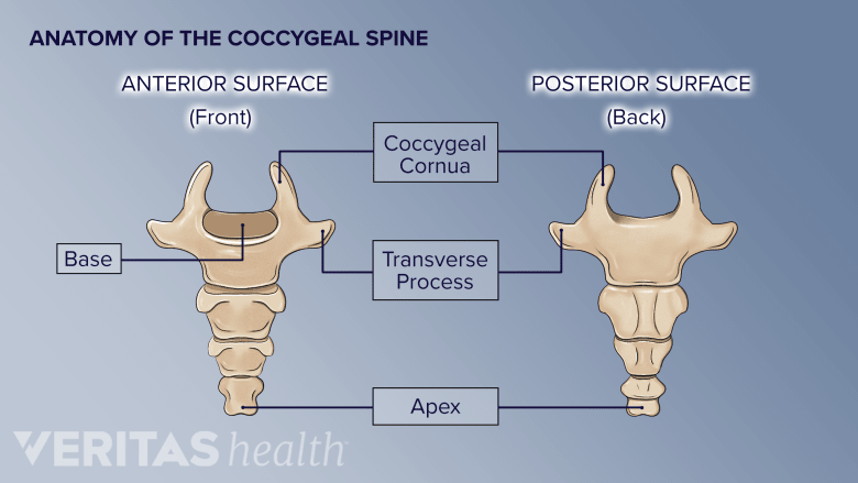 Coccydynia (Tailbone Pain) | Spine-health