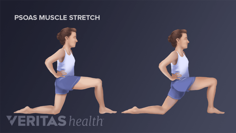 The Essential Role of the Psoas Muscle | Spine-health