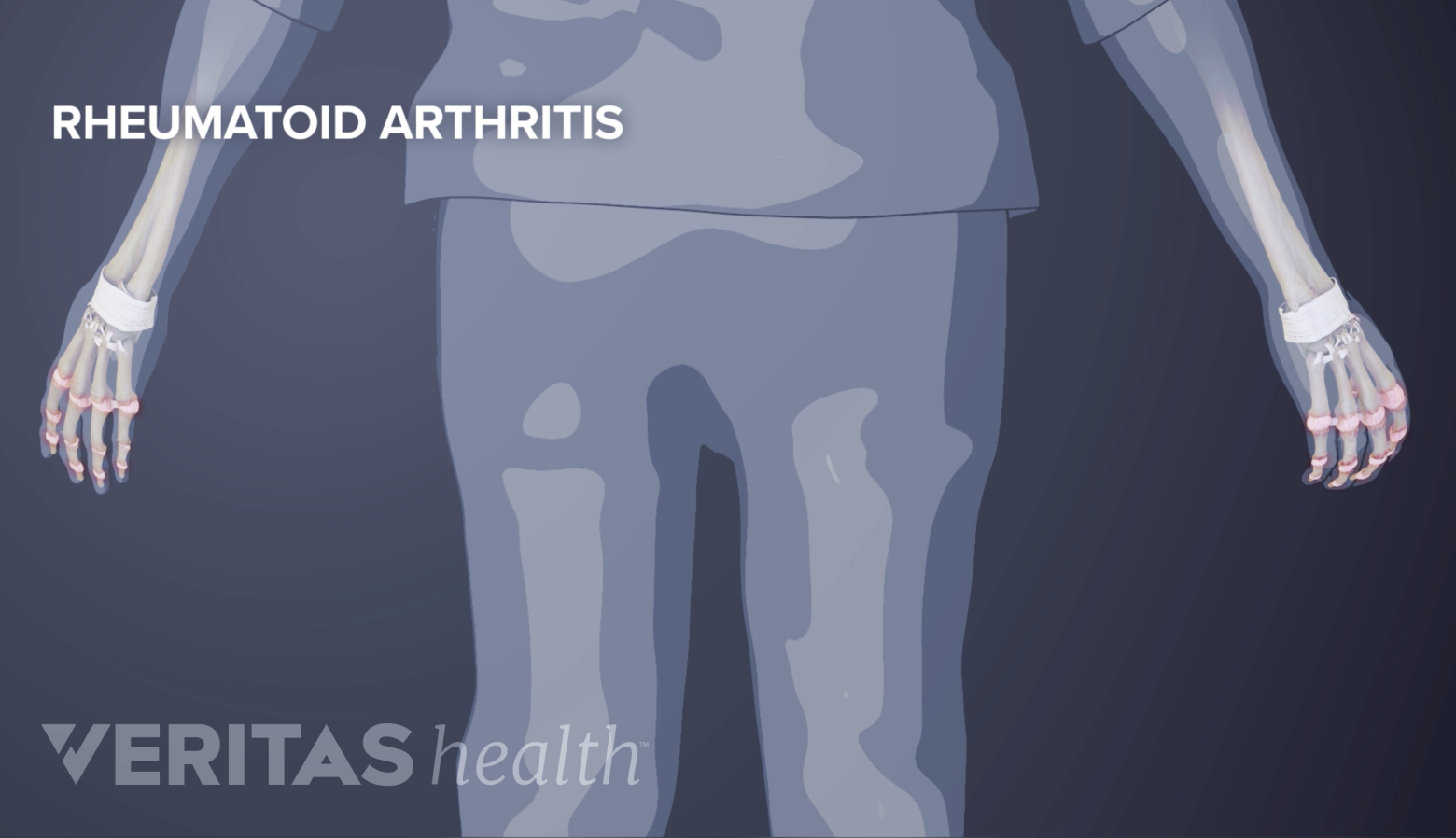 What Causes Hand Pain and Numbness? | Spine-health