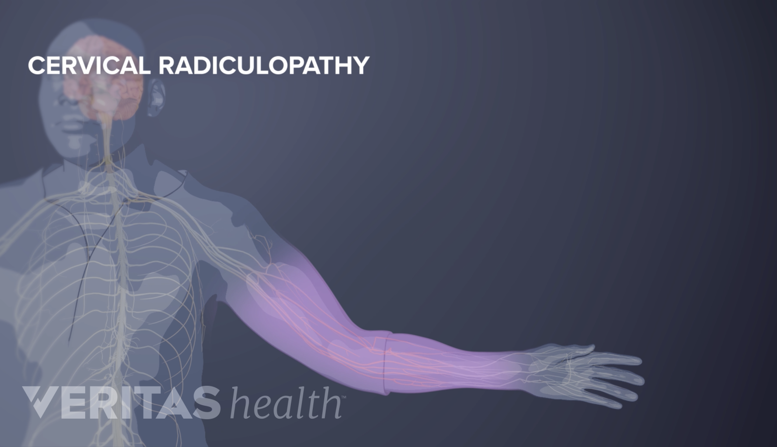 What Causes Hand Pain and Numbness? | Spine-health