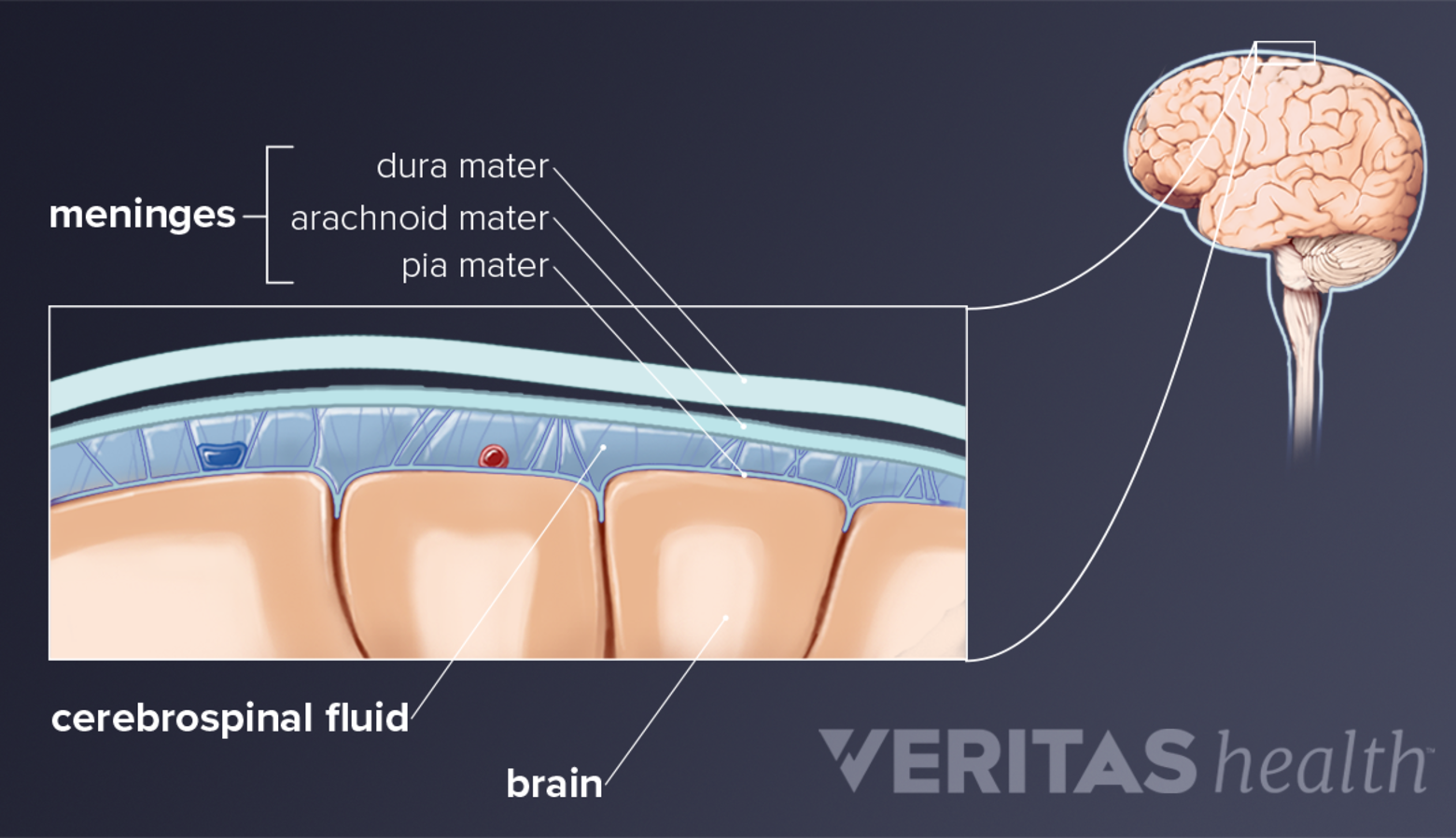 How Neck Pain and Headache Can Occur Together | Spine-health