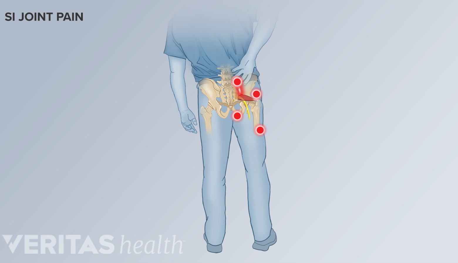 Exercise for Sacroiliac Joint Pain Relief | Spine-health