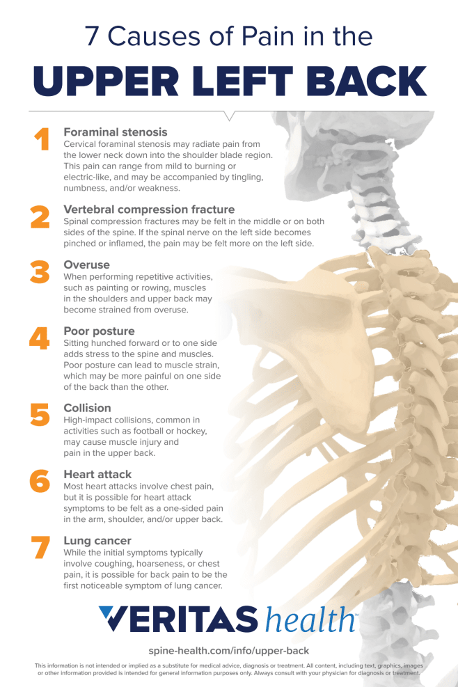 7 Causes of Pain in the Upper Left Back Infographic | Spine-health