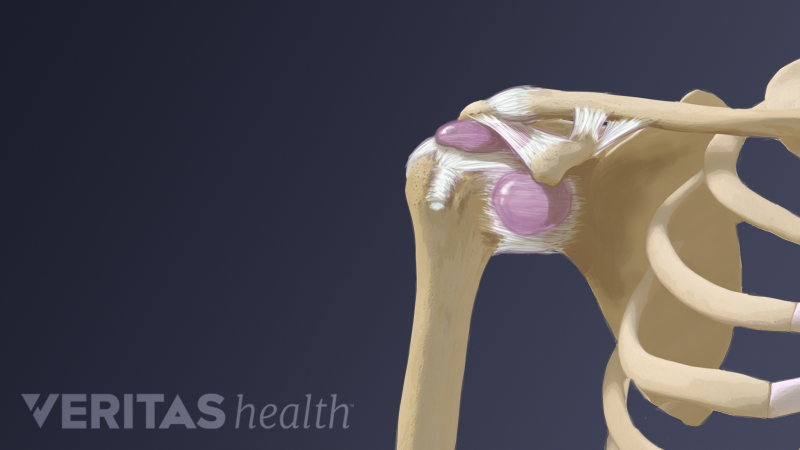 Bursitis | Arthritis-health
