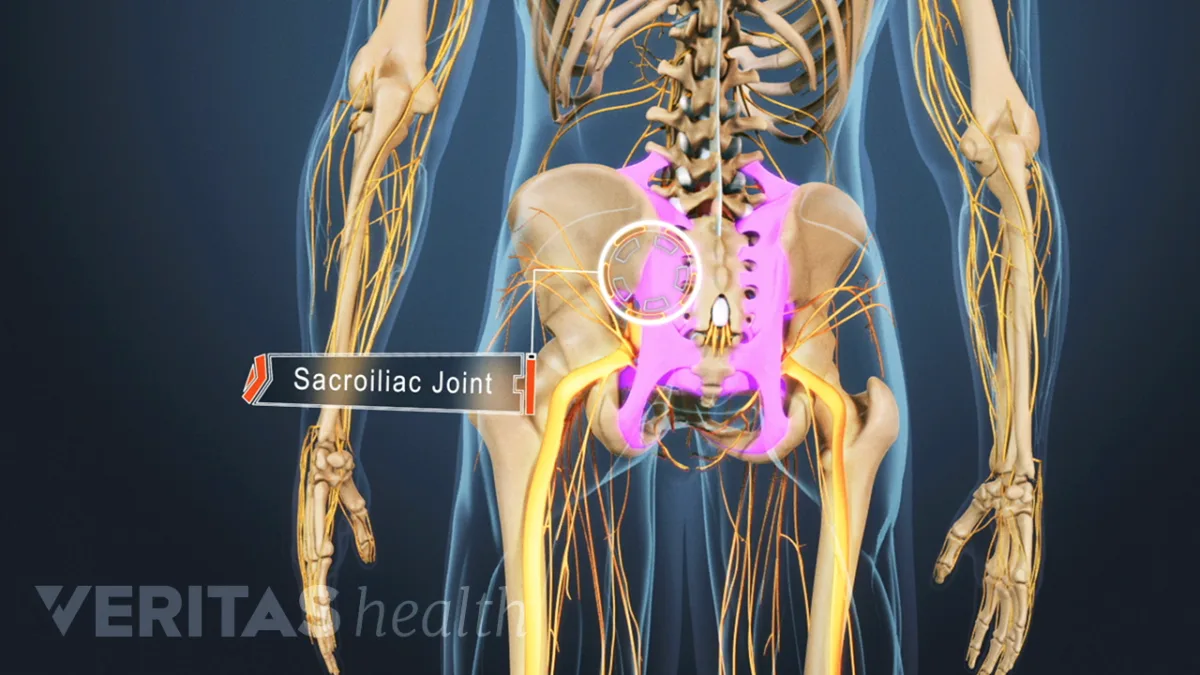 Mild Degenerative Sacroiliac Joint