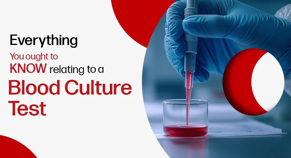 Blood Culture Test: Full Guide | Private Blood Tests London