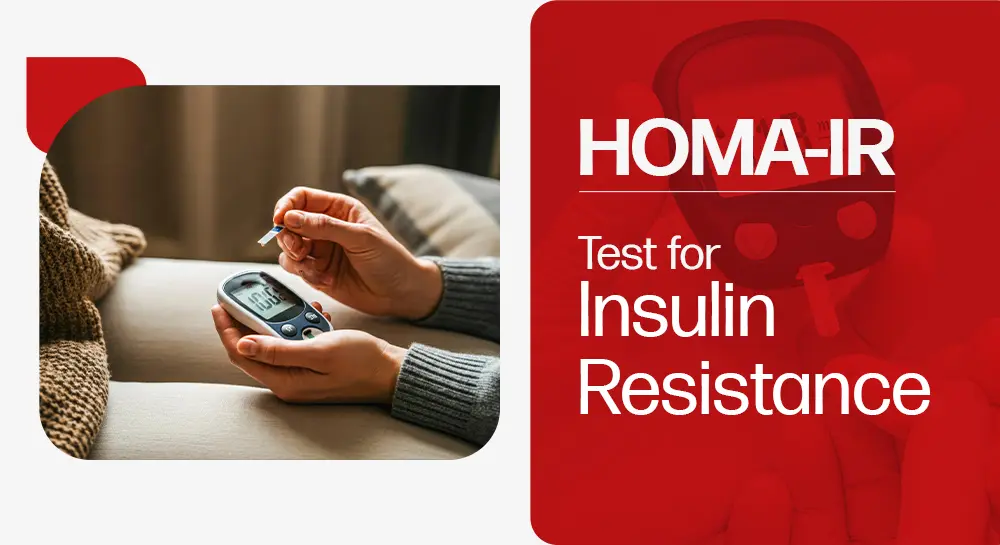 HOMA-IR Test for Insulin Resistance | Private Blood Tests London