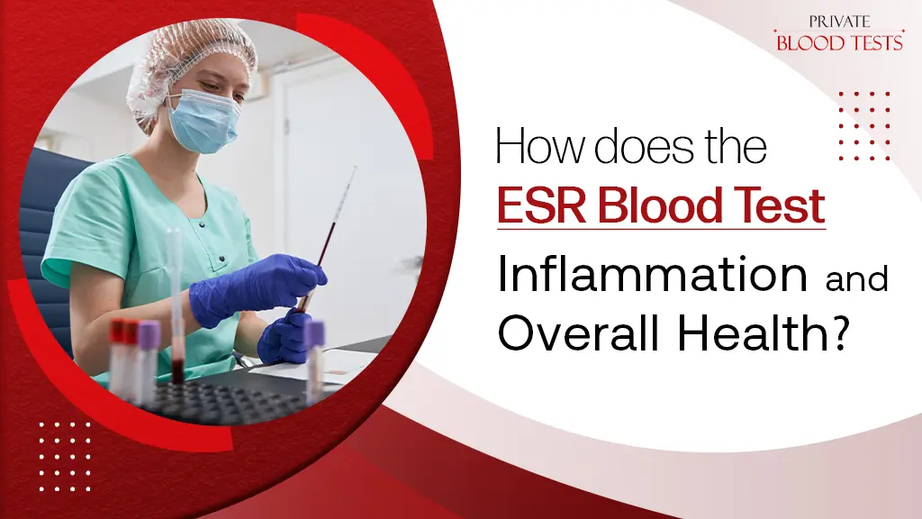 ESR Blood Test: Inflammation Detection | Private Blood Tests London