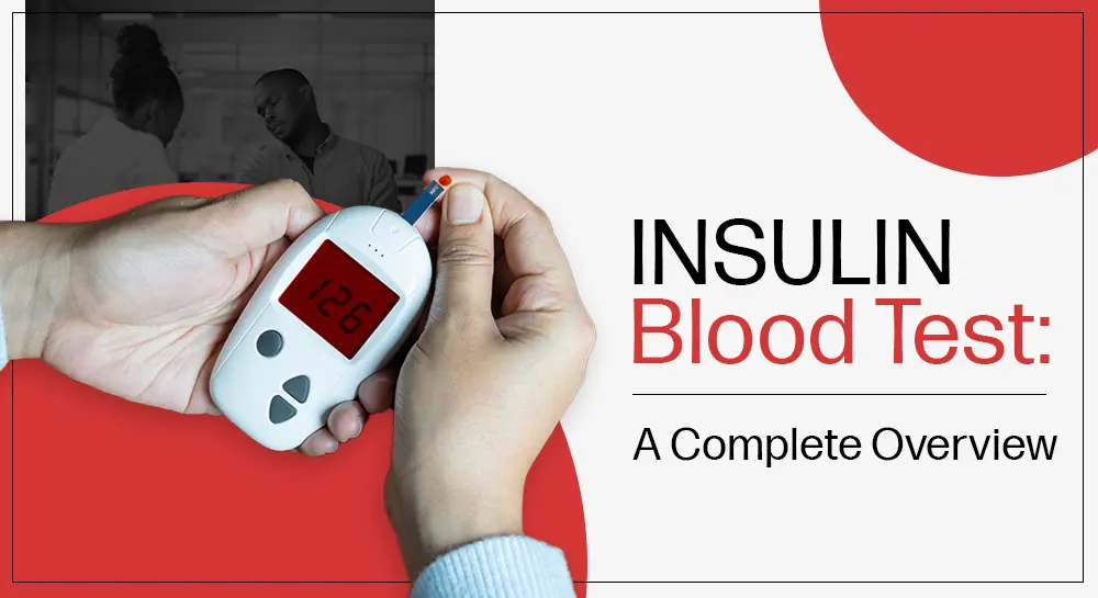 Insulin Blood Test: Complete Overview | Private Blood Tests London