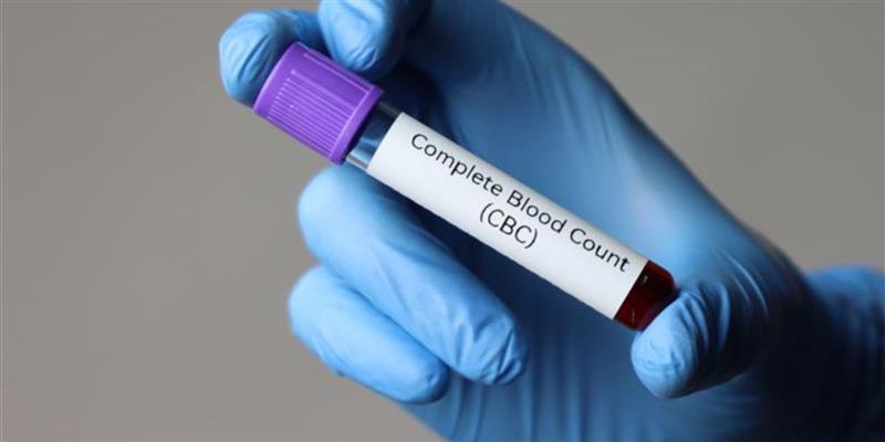 What Is a Full Blood Count? FBC Blood Test Explained | Walk in Clinic