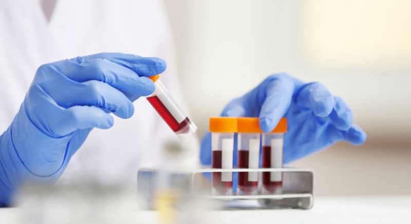 What Is RBC in Blood Test? RBC Count & Normal Range Explained | Private ...
