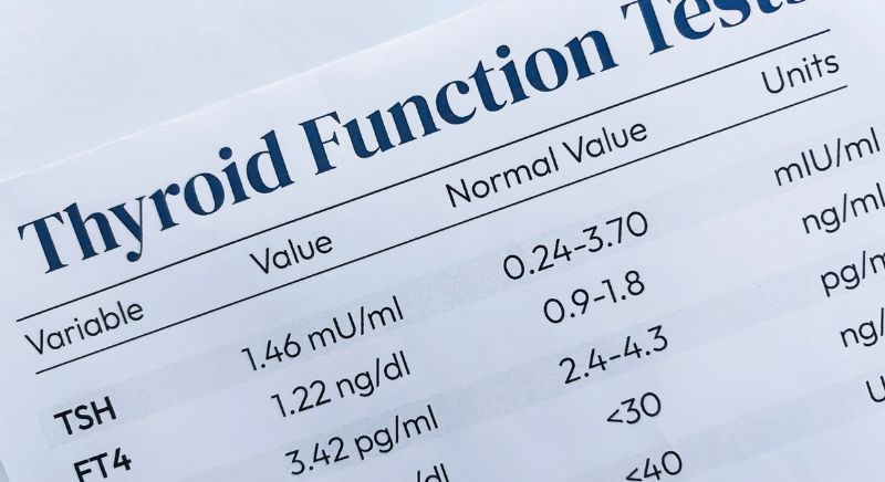 Thyroid Function Test Explained Simply | TSH, T3 & T4 Guide UK ...