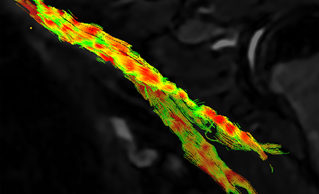 Advanced MR imaging with AI from peripheral nerves to knee cartilage ...