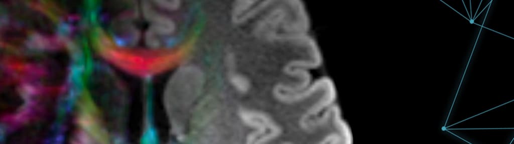 FDA approves first PSMA-targeted PET imaging radiotracer for men with ...