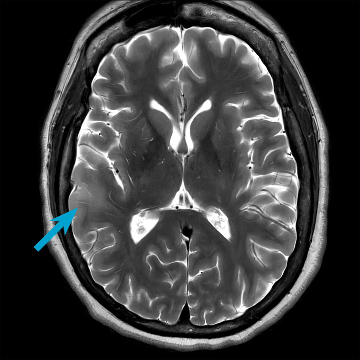 Investing in cutting-edge MR technology helps Envision Radiology be a hero to patients