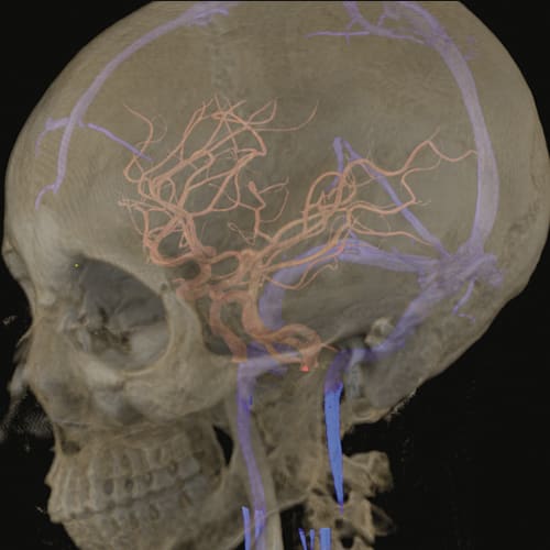 Dedicated neuro MR imaging with MAGNUS