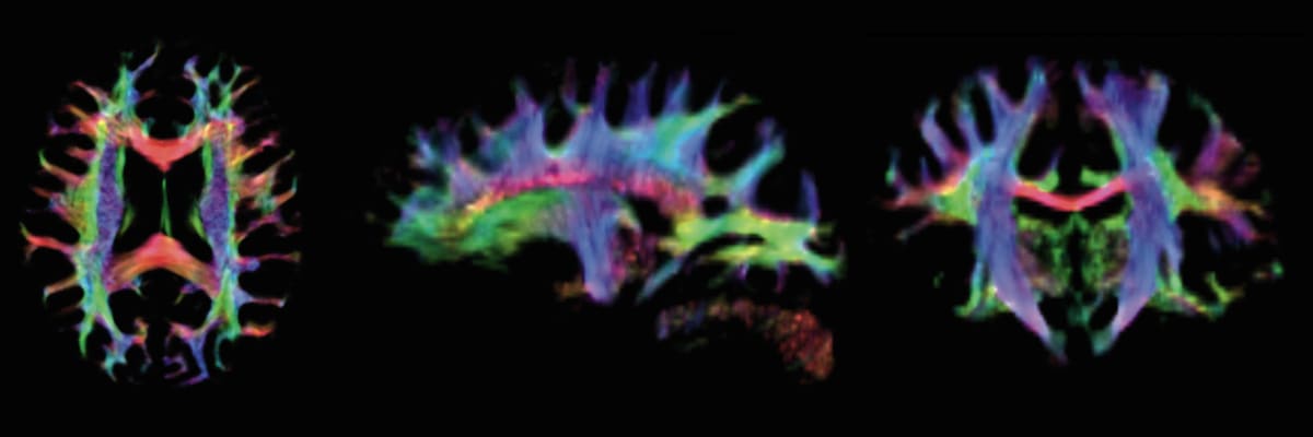 Development of high-performance gradient systems