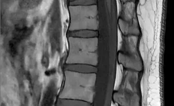 Fleury Group brings MR for everyone in Brazil