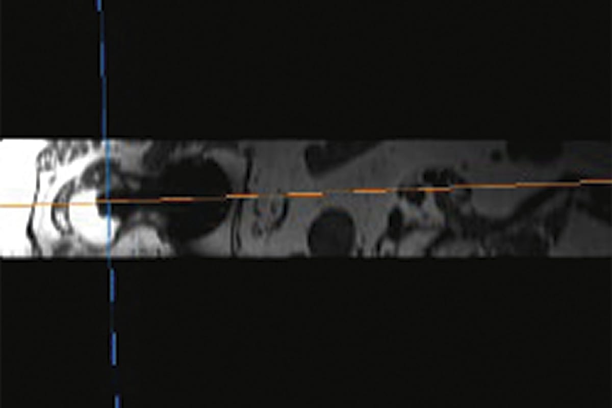 No bones about it: improved MAVRIC SL and new HyperMAVRIC SL deliver ...