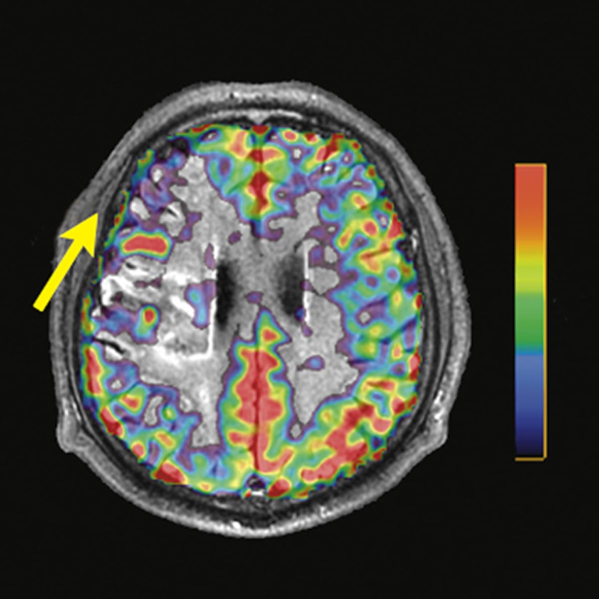 Advancing the clinical utility of PET/MR in China is making a ...