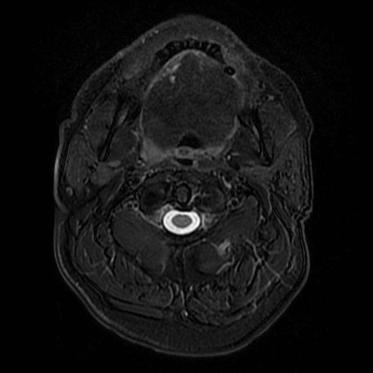 Improving soft tissue neck imaging with shorter scan times, robust fat ...