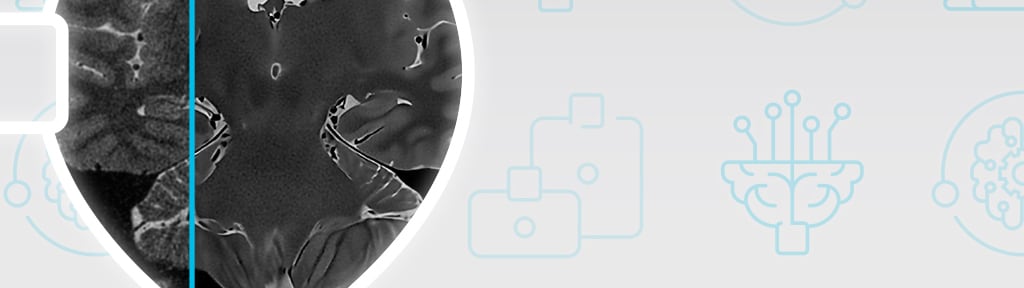 DWI can streamline breast MR exams