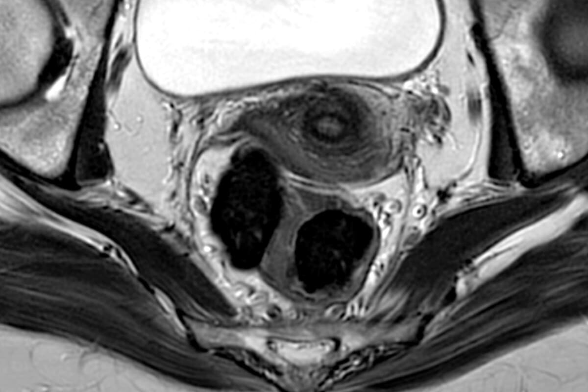 AIR a true asset in the land of Kiwis