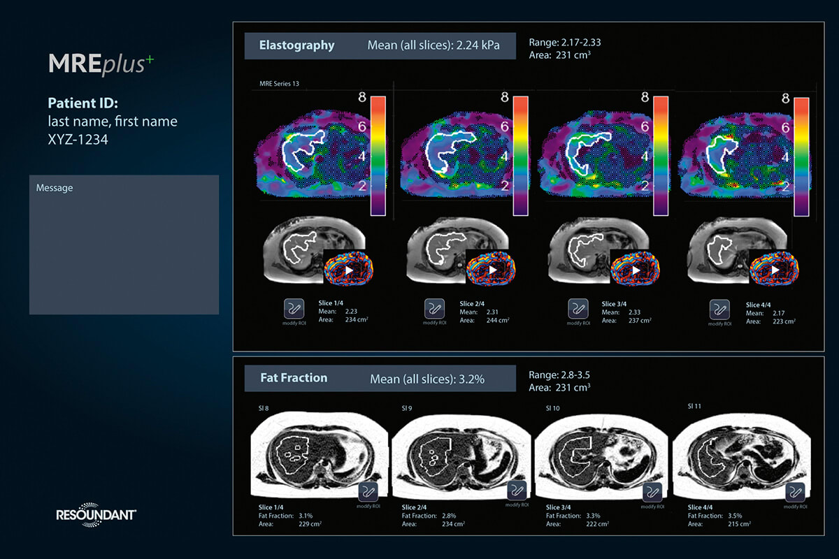 The growing need for a comprehensive, non-invasive liver health assessment