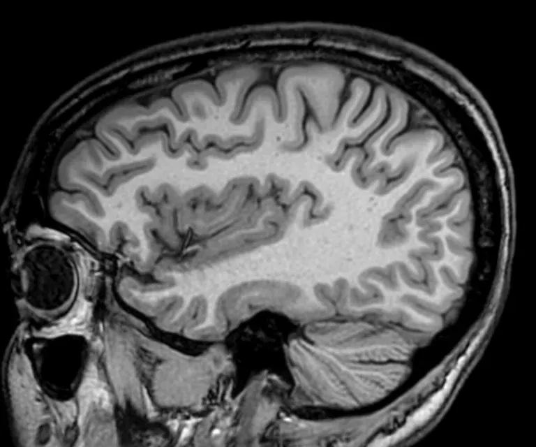 A vision for bringing connectome to the clinic