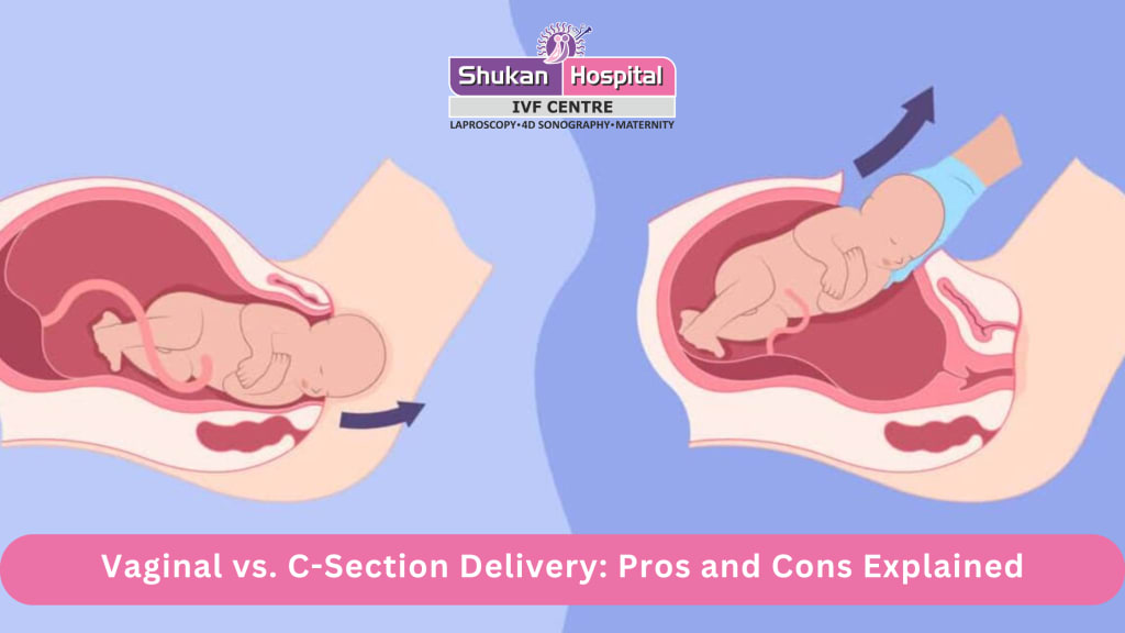 Vaginal vs. C-Section Delivery: Pros and Cons Explained - Shukan Hospital and IVF Center