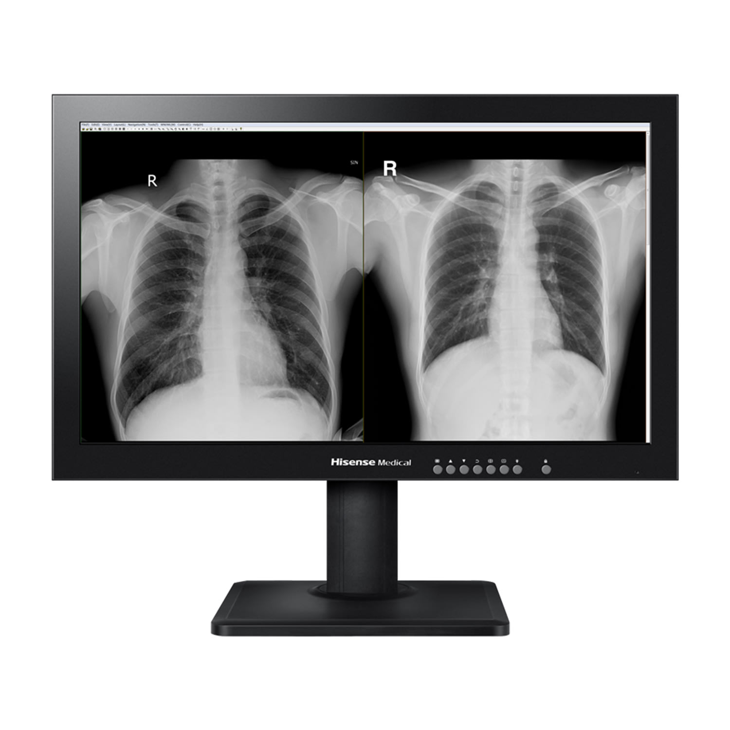 Medical. Hisense Commercial Display