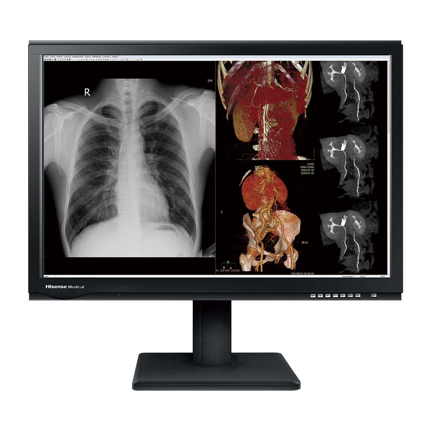 Medical. Hisense Commercial Display