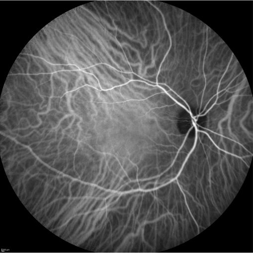 West Coast Retina Footer