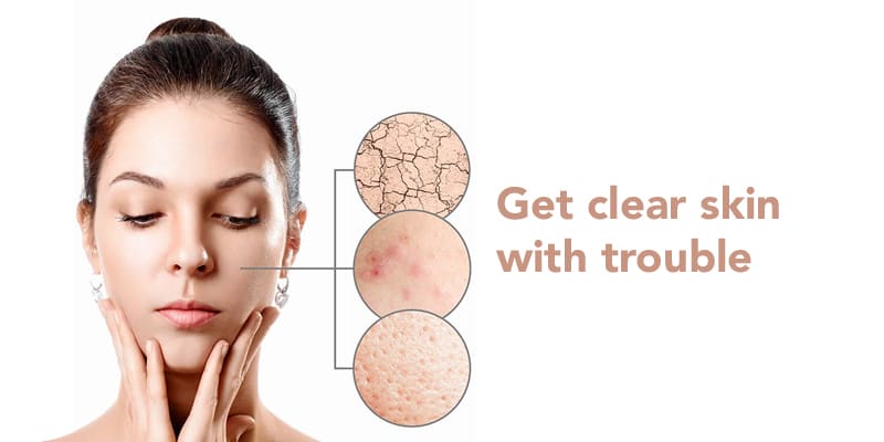 Scar Removal Cream Would Be A Smart Move - Get Clear Skin