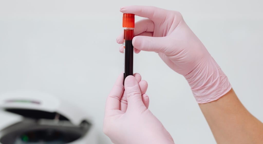 ApoB Test: 2026 Apolipoprotein B Guide For Clarity