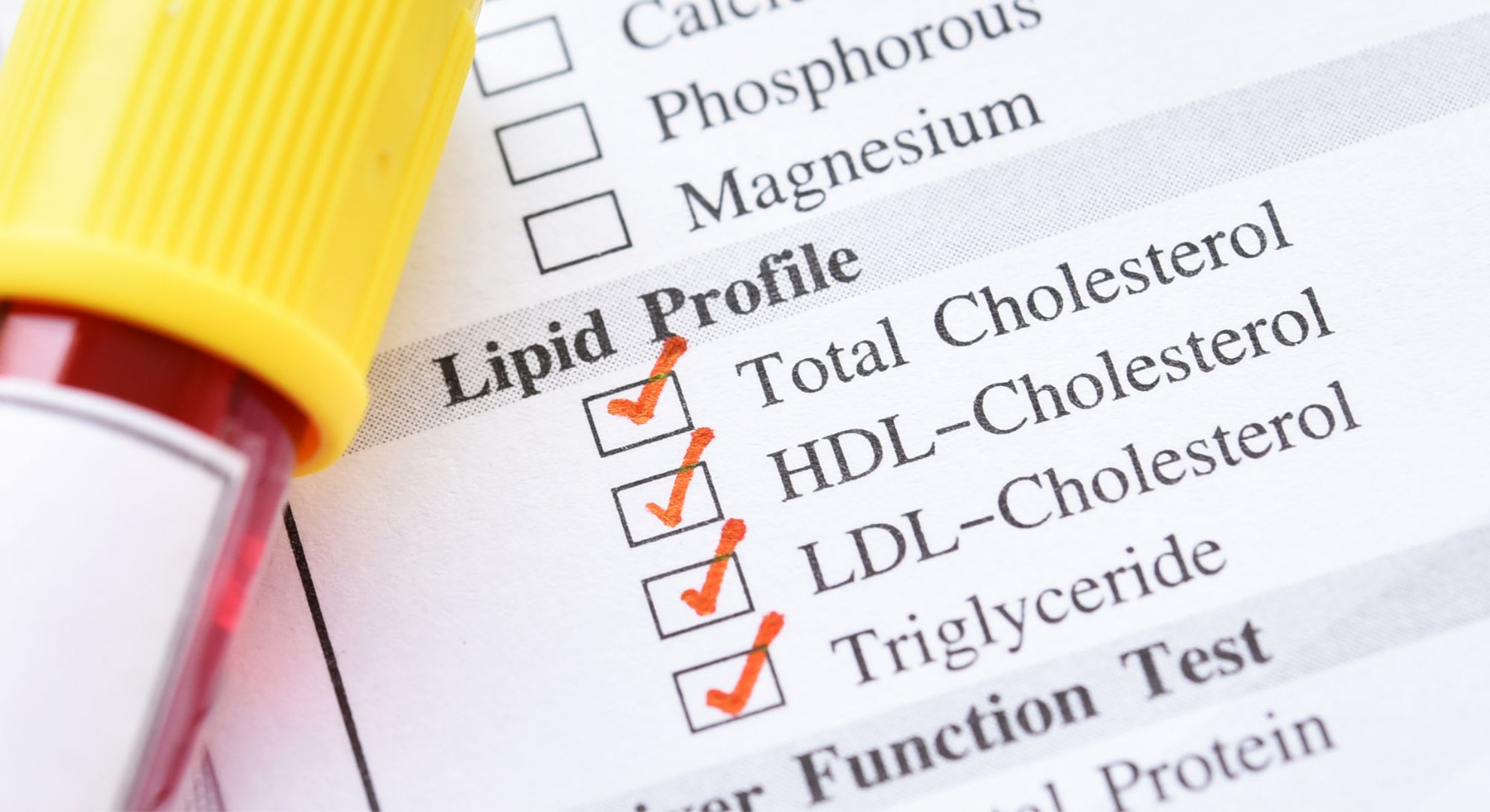 ApoB Test: 2026 Apolipoprotein B Guide For Clarity