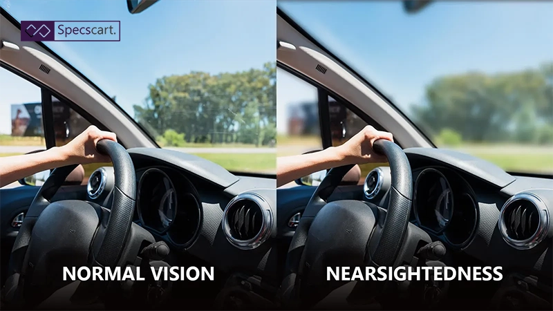 What is nearsightedness? What's its symptoms and treatment?