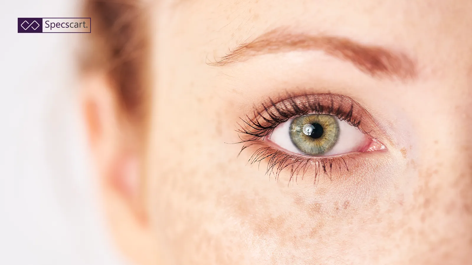 What You Must Know About Intriguing Eye Freckles? | Specscart